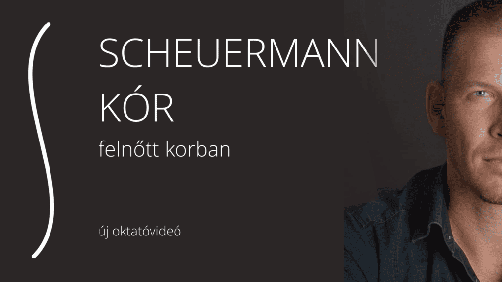 Scheuermann - ha már felnőtt vagy